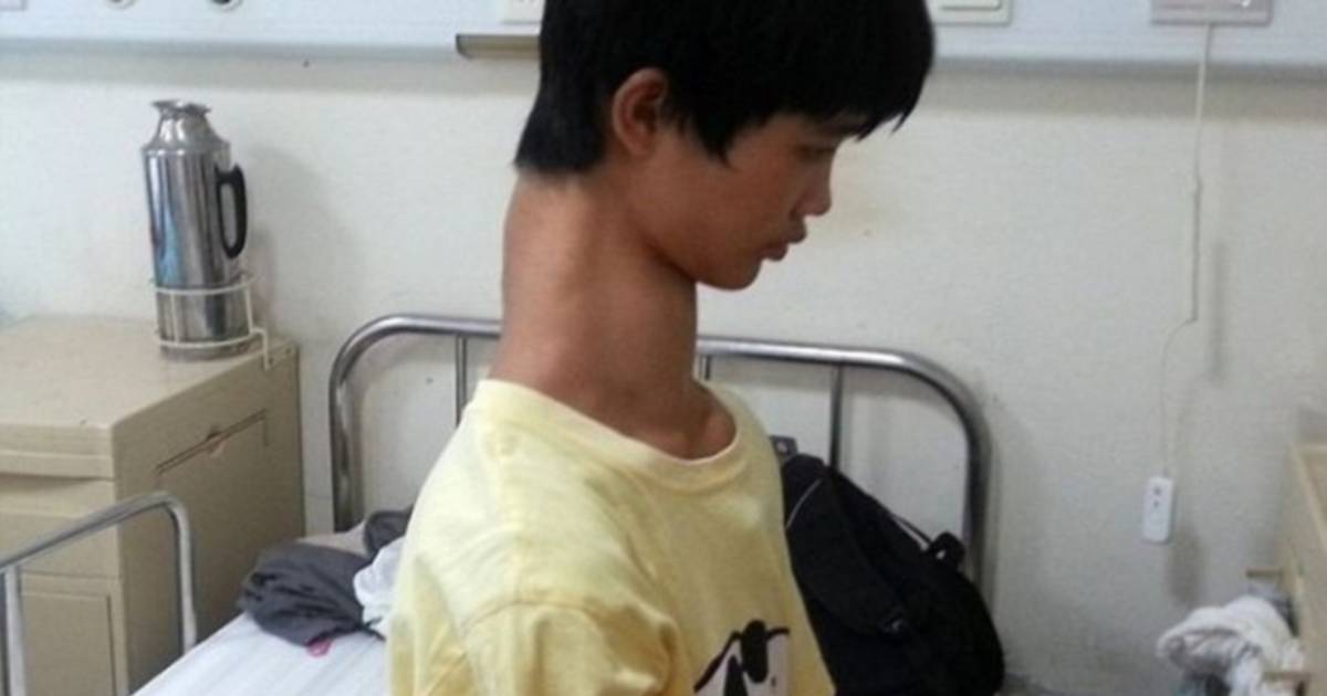 El increíble caso del chico jirafa y su pedido desesperado